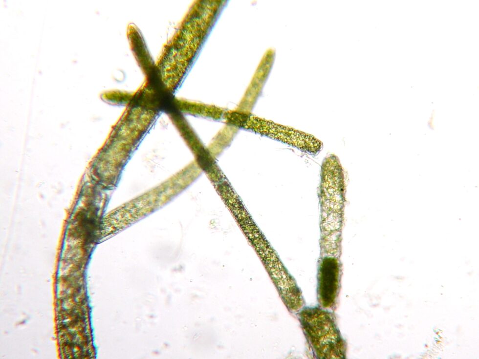 Algae & Weed Identification | Clean Ponds | Pond Lake Management